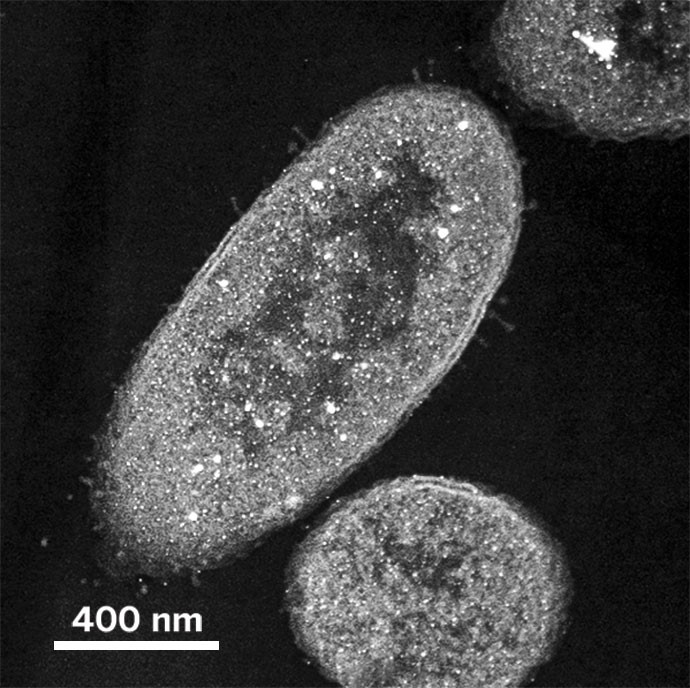 The Dawn of Zombie Bacteria | TECOLAB